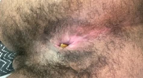 Twink Turtle Heading Say Hi