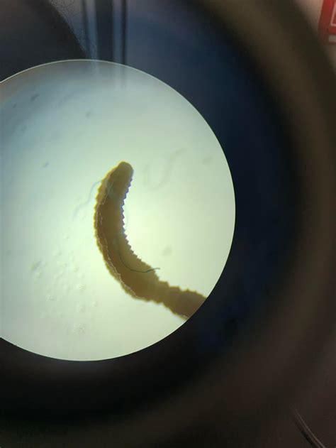 What Is This Worm Hookworm Pg 215 Rparasites