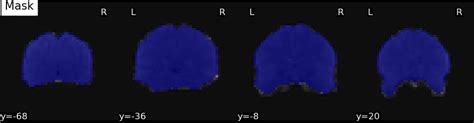 nilearn statistical analysis for neuroimaging in python — machine