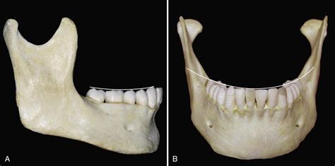Maxillary Arch Occlusal View Anatomy