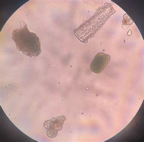 Other Eukaryotes Flashcards Quizlet