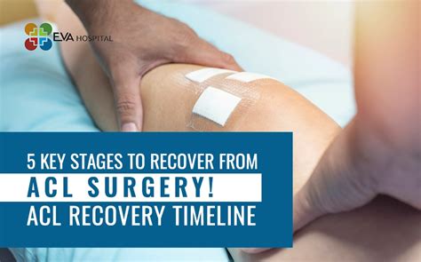 5 Key Stages To Recover From Acl Surgery Acl Recovery Timeline Eva Hospital