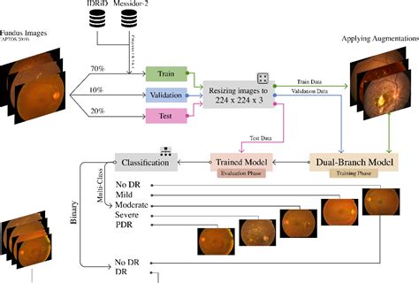 Figure 1 From Dual Branch Deep Learning Network For Detection And Stage Grading Of Diabetic