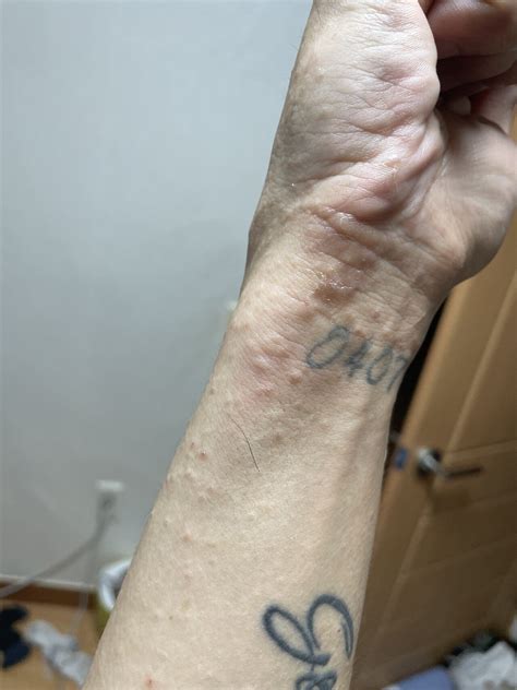 혐주의 화이자 백신 부작용 후기 포텐 터짐 최신순 에펨코리아