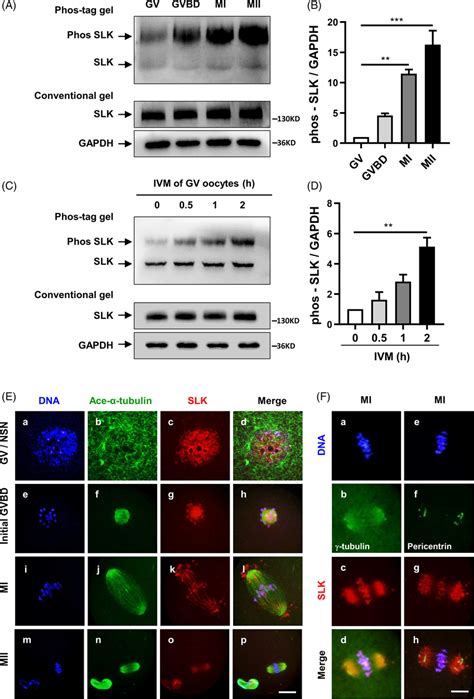 Expression And Subcellular Localization Of Ste20‐like Kinase Slk In