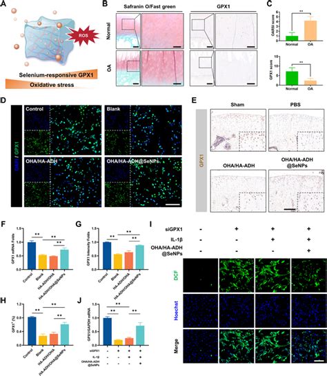 Injectable Hydrogel With Selenium Nanoparticles Delivery For Sustained Glutathione Peroxidase