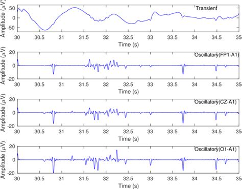 Retrieved Low Transient And High Oscillatory Components Of Segment 7 Download Scientific