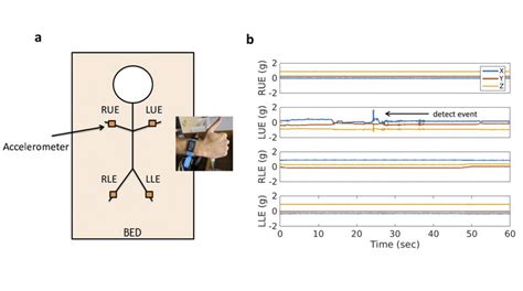 use of accelerometry for long term monitoring of stroke patients ieee