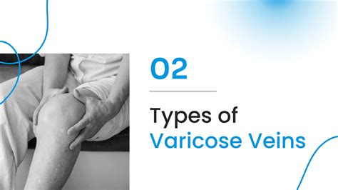 Varicose Veins Types Symptoms Pptx