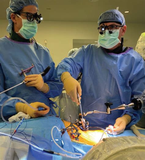 Rushs Use Of Excelsius Robot In Adult Deformity Idiopathic Scoliosis And Lateral Lumbar