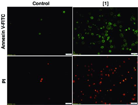 Fluorescence Microscopy Analysis Of Annexin V Fitc Staining A549 Lung Download Scientific