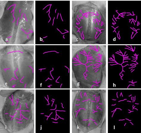 Representative Photographs Of The Microvasculature Pink In The Tissue Download Scientific