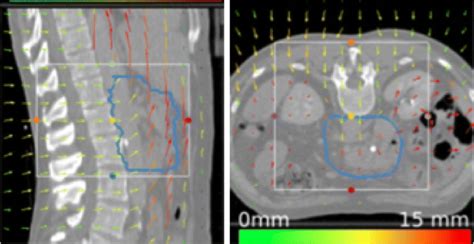Vector Field Representation Obtained From The Deformable Image Download Scientific Diagram