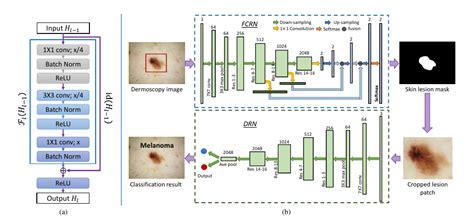 Automated Melanoma Recognition In Dermoscopy Images Via Very Deep Residual Networks
