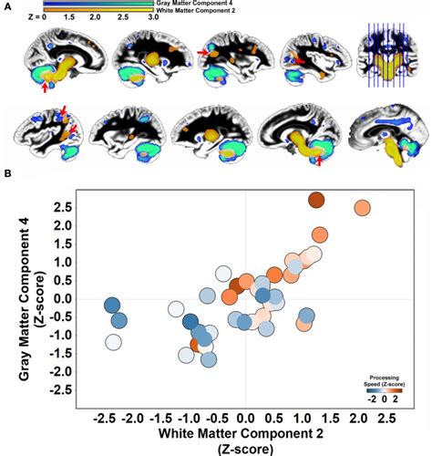 Structural Covariance Between Cerebellar Gray Matter And Brainstem Download Scientific Diagram