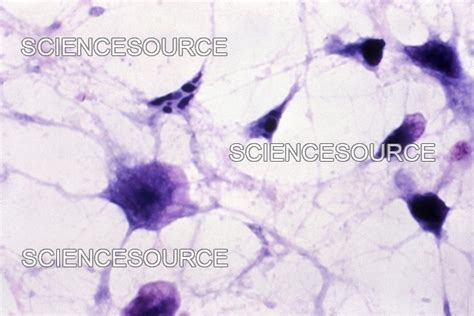 Clostridium Difficile Bacteria Light Stock Image Science Source Images