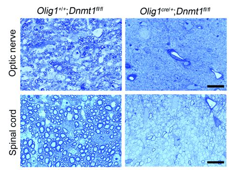 Figure S3 Conditional Ablation Of Dna Methyltransferases In Download Scientific Diagram