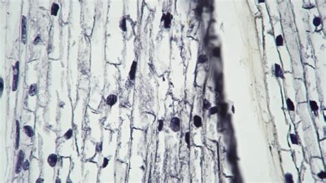 Root Tip Of Allium Cepa In Longitudinal Section Magnified By Microscope