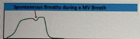 Capnography Waveforms Flashcards Quizlet