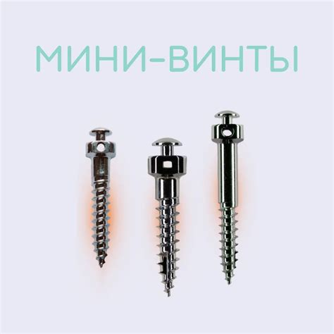 СТОМАТОЛОГИЯ «АЛМАЗ»💎ОМСК | Мини-винты, что это такое и зачем они нужны ...