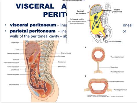Visceral Peritoneum Vs Parietal Peritoneum