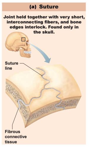 Incomplete Joints Classifications Flashcards Quizlet