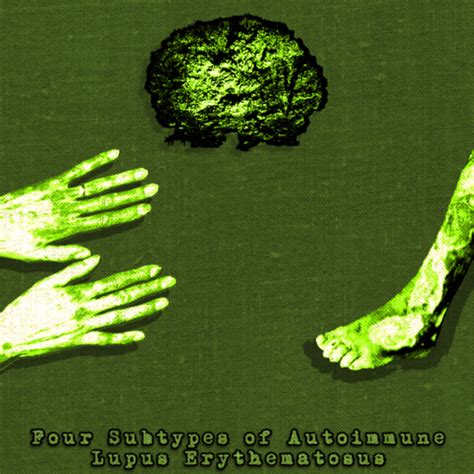 Four Tracks For Four Subtypes Of Autoimmune Lupus Erythematosus