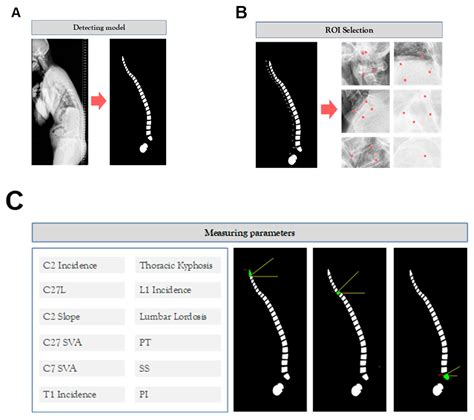 Bioengineering Free Full Text Ai Driven Segmentation And Automated Analysis Of The Whole