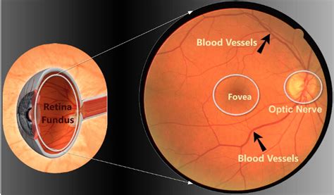 Retinal Fundus Image Cross Section Download Scientific Diagram