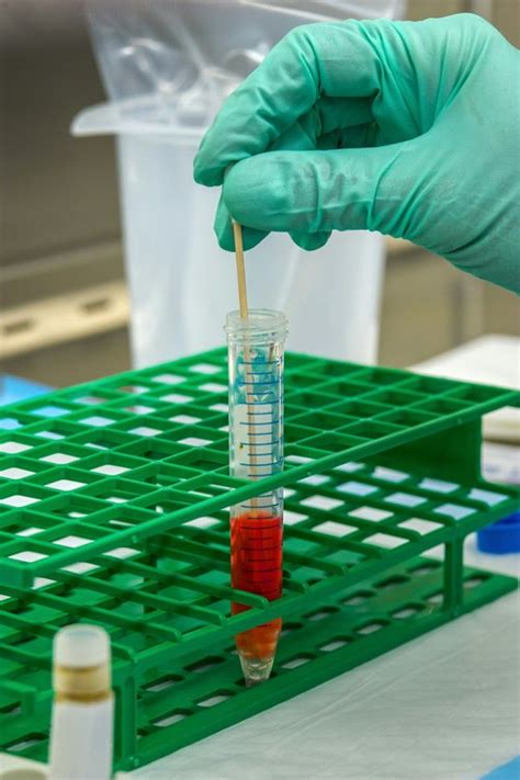 Lyme Disease Testing Options 5 Reliable Labs Lyme Warrior