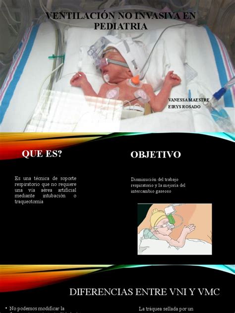 Ventilación No Invasiva En Pediatría Pdf Neumología