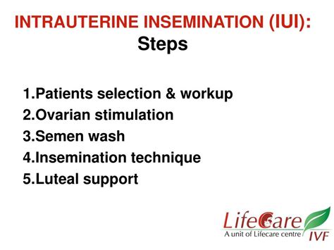 PPT IUI A To Z PowerPoint Presentation Free Download ID