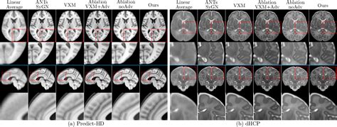 Figure 2 From Generative Adversarial Registration For Improved Conditional Deformable Templates