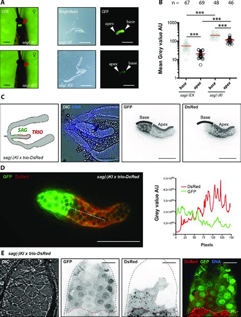 Fluorescent Reporter Expression In The Median Lobe Reveals Spatial Download Scientific Diagram