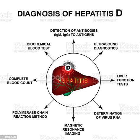 Diagnosis Hepatitis D Hari Hepatitis Sedunia Infografis Ilustrasi