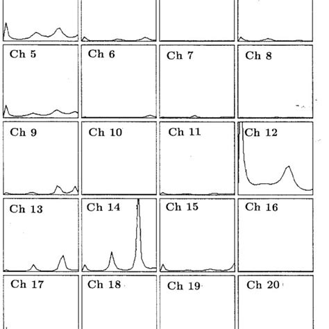 Electrode Array And Ecog Recordings A Electrode Array On The Download Scientific Diagram
