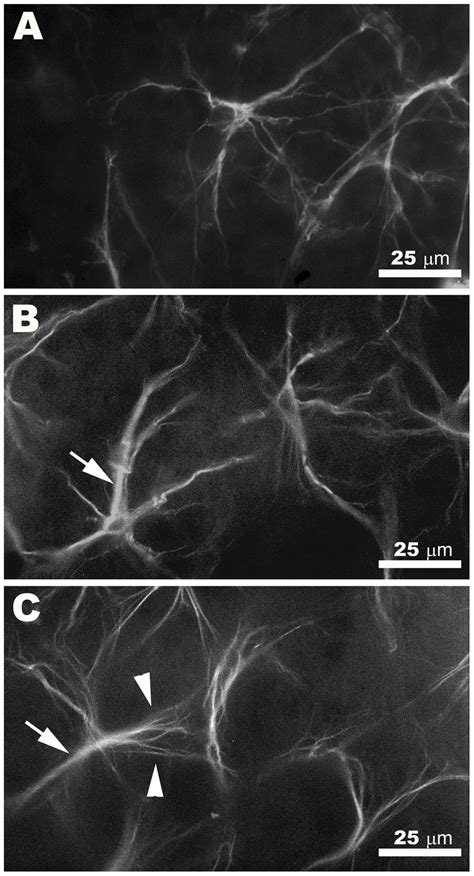 Morphological Features Of Retinal Astrocytes In Wt And And Super Download Scientific Diagram
