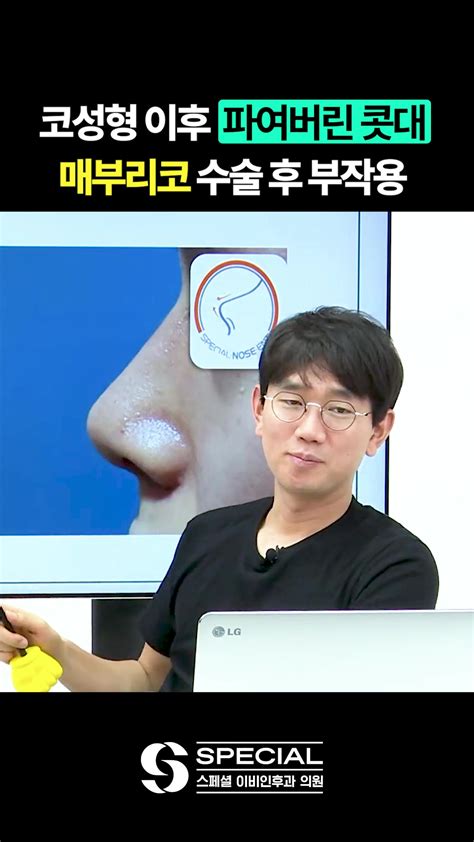 스페셜이비인후과 올바른 코성형은 👃 기능과 미용 동시에 개선하는 수술 스페셜코성형클리닉 기능성코성형 코성형잘하는곳 비염코성형 스페셜이비인후과 강남성형외과