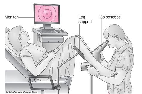 Coding For Colposcopy Obgyn Cpt Codes And Modifiers For 2025 Eoys