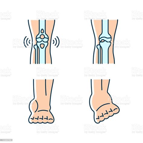 관절염 다리 통증 Rgb 색상 아이콘 세트 건강 진단에 대한 스톡 벡터 아트 및 기타 이미지 건강 진단 건강관리와 의술 무릎 Istock