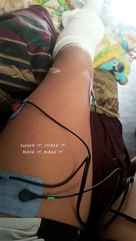 Meniscectomy Recovery Faq What To Know About Meniscus Surgery Just