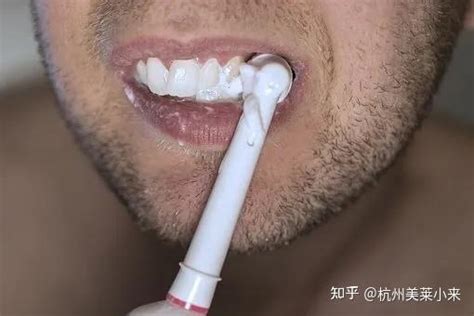 牙龈炎和牙周炎的区别怎么治疗 知乎