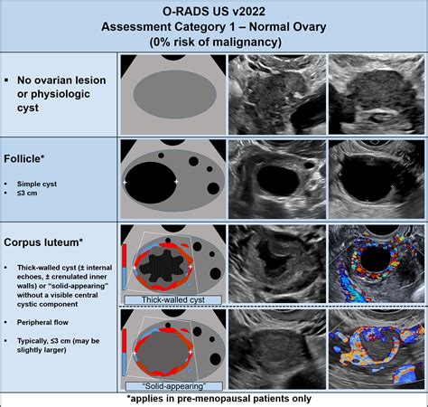 O Rads Us V2022 An Update From The American College Of Radiologys