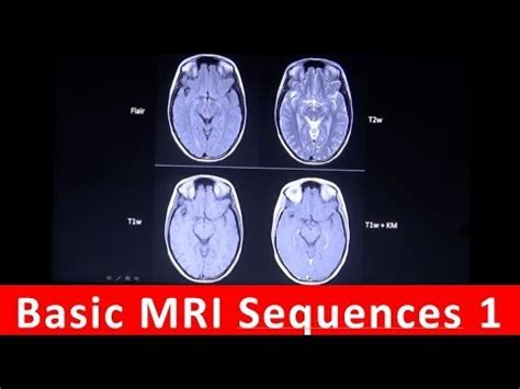 Basic Mri Sequences Part 1 By Radiology Tv Youtube
