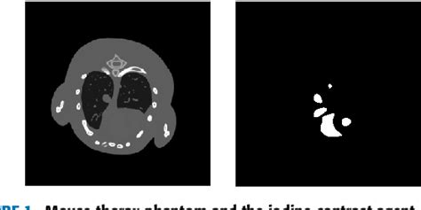 Figure 1 From Spectral Ct Reconstruction Based On Piccs And Dictionary Learning Semantic Scholar