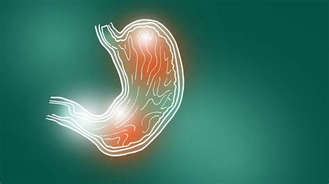 What Is Stomach Cancer Understanding Symptoms Treatment And