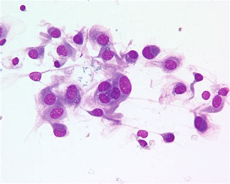 Cytology Of Lumps And Bumps The Common Stuff Veterinary Medicine At Illinois