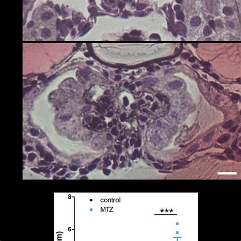 Morphometry Of Pecs Following Podocyte Depletion Panel A Shows Download Scientific Diagram