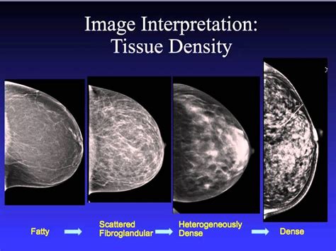 Healthy Mammogram Results