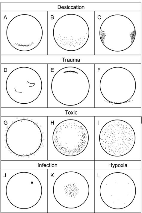 Schematic Representation Of Various Patterns Of Corneal Fluorescein Download Scientific Diagram